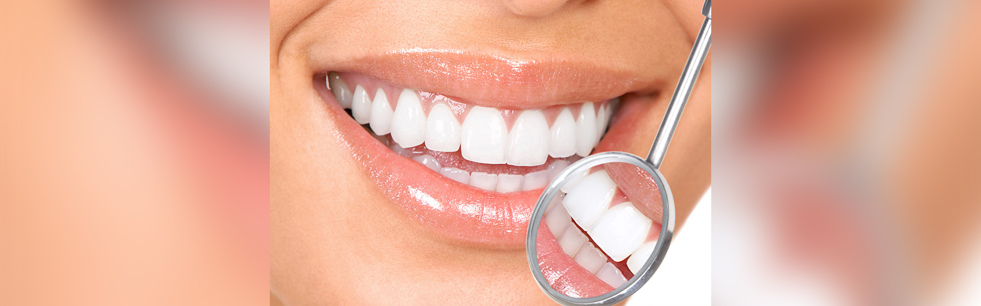 Some Benefits to Giving Your Smile an Extra Boost